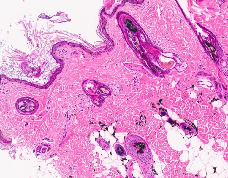 Farbmutantenalopezie (Colour Dilution Alopecia/CDA) : LABOKLIN Bad ...