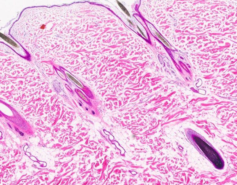 Farbmutantenalopezie (Colour Dilution Alopecia/CDA) : LABOKLIN Bad Kissingen