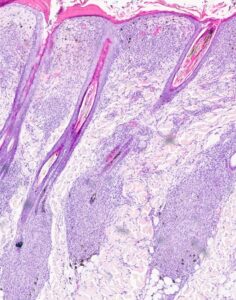 Farbmutantenalopezie (Colour Dilution Alopecia/CDA) : LABOKLIN Bad ...